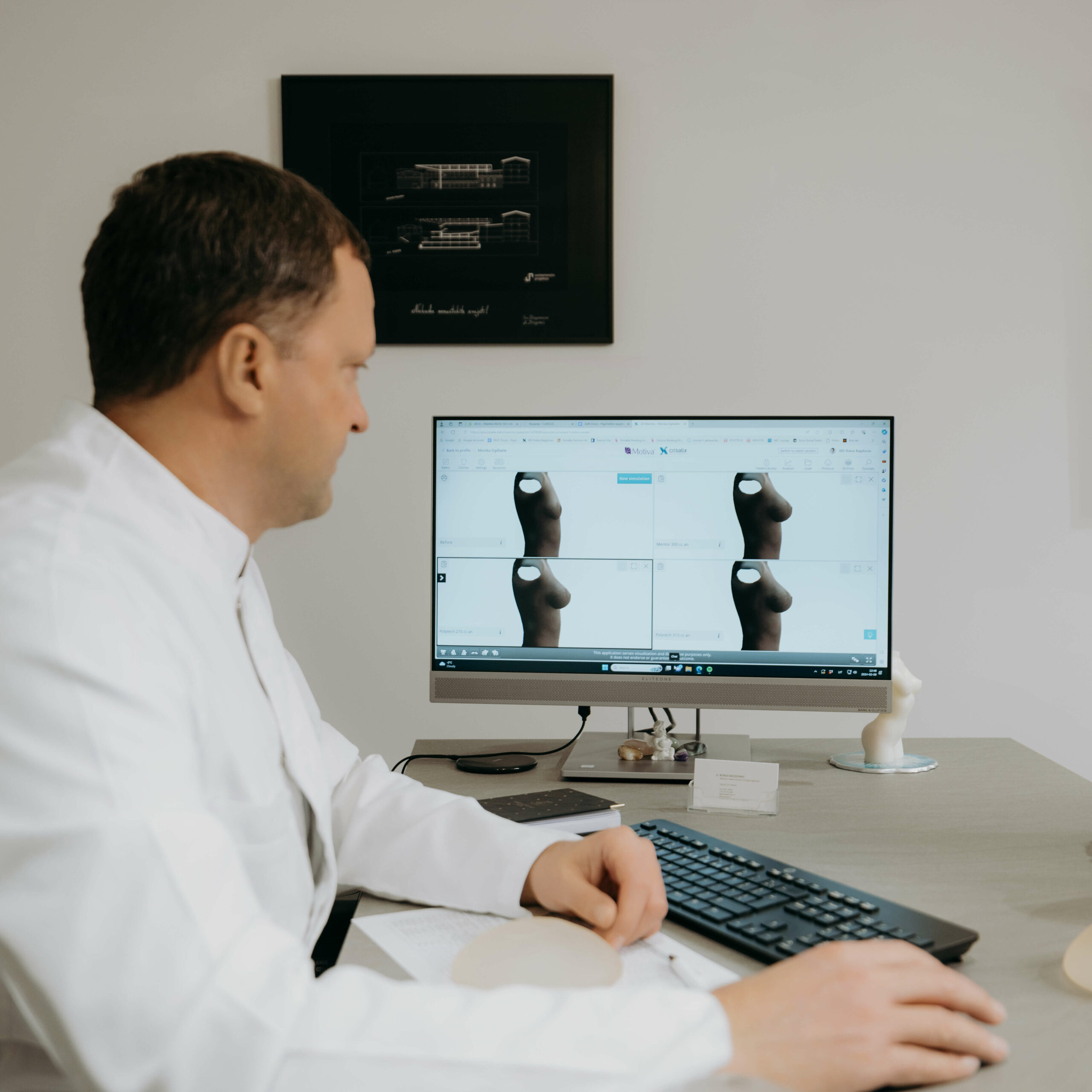 3D visualizations - CLINICUS